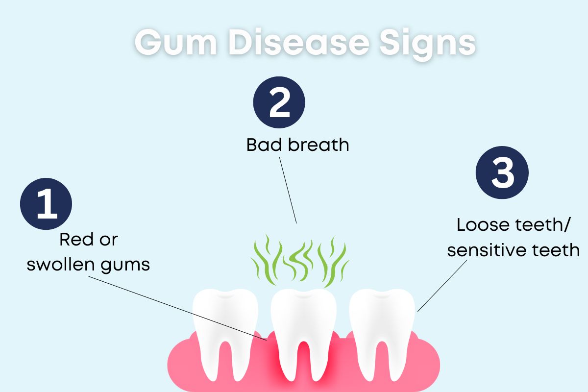The Stages of Gum Disease: From Gingivitis to Periodontitis - Imagine ...
